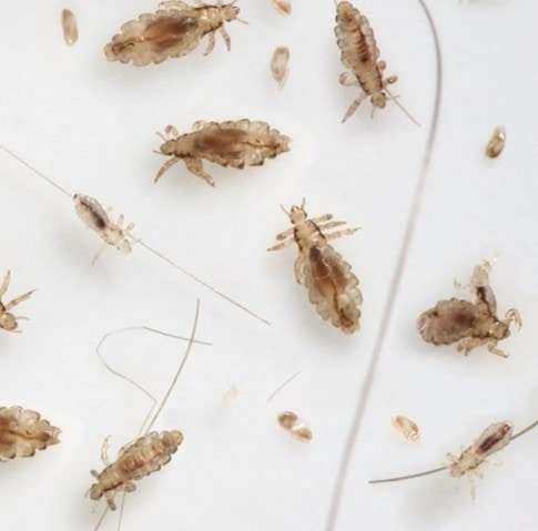 Best Nit Comb NZ #1 Metal Teeth Head Lice & Nit Removal